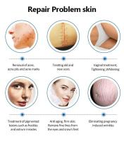 China Co2 Laser 10600nm Laser Co2 Fractional Skin Resurfacing Machine for sale
