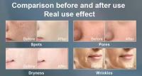 China Dpl Nir Skin Rejuvenation Ipl Hair Removal Machine Dpl Opt Acne Therapy Machine for sale