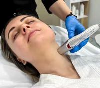 China Portable 5Mhz Fractional RF Device for Face Lift and Skin Tightening for sale