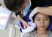 China Cooling Skin Water Cooling 5D ICE HIFU Face Lifting Machine for sale
