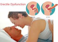 China Erectile Dysfunction Physiotherapy Shockwave Therapy Machine for sale
