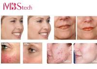 China Moisturizing Photon Led Photodynamic Therapy Equipment for sale