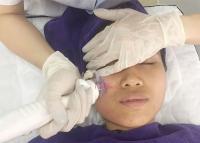 China Noninvasive Weight Loss 10 Pins Microneedling Rf Machine for sale