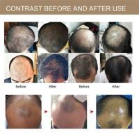 China 650nm Led Light 30 Diode 26 Lasers Hair Growth Helmet Laser Therapy For Hair Loss for sale