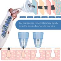 China Pore Cleaner Extractor De Espinillas Productos De Belleza Blackhead Remover Vacuum for sale