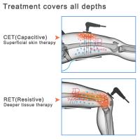 China Tecar 3.0 Touch Screen RET CET FR Physio Therapy Machine For Commercial for sale