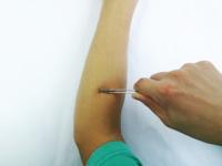 China Streamlined Trauma Disposable Surgical Stapler Skin Stitching Stapler for sale