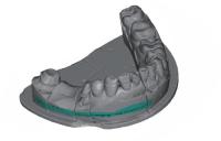 China LScan 8μm High Accuracy Dental Lab Scanner with 10 Second Full-Arch Scan and Full-Color Texture Open System for sale