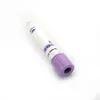 China EDTA K2 K3 Vacuum Blood Collection Tubes 2ml-10ml with CE Certification for Clinical Hematology Testing for sale