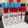 China Siny HA & Sodium Citrate PRP Vacuum Blood Collection Tubes 8-15ml with Gel for Single Centrifugation for sale