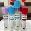 China Siny Medical Disposable Vacuum Blood Collection Tube with Calcium Chloride for PRP - 8-15ml Capacity, ISO Certified for sale