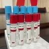 China Siny Medical Disposable Vacuum Blood Collection Tube with Calcium Chloride for PRP - 8-15ml Capacity, ISO Certified for sale