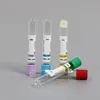 China Siny Disposable PRP Tube 16×100mm with Sodium Citrate Solution for Blood Collection - 8-15ml Capacity for sale
