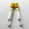 China Siny Disposable PRP Tube 16×100mm with Sodium Citrate Solution for Blood Collection - 8-15ml Capacity for sale