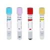 China PRF Blood Collection Tubes 16×100mm & 16×120mm with 8-15ml Capacity for Medical Applications for sale