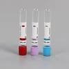 China PRF Blood Collection Tubes 16×100mm & 16×120mm with 8-15ml Capacity for Medical Applications for sale