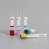 China PRF Blood Collection Tubes 16×100mm & 16×120mm with 8-15ml Capacity for Medical Applications for sale