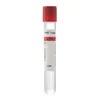 China Siny Medical A-PRF Tubes 16x100mm and 16x120mm Glass/PET with 8-15ml Draw Volume for Regenerative Medicine for sale