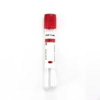 China Disposable PRP Tube for Platelet Rich Plasma Therapy - 16×100mm/120mm Size with 8-15ml Capacity for sale