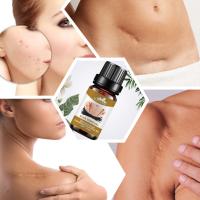 China Pure Anti Scar Oil Removing 10ml Facial Scar Essential Oil ODM USDA for sale