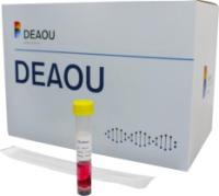 China Latest Rapid Test Kit Rapid Diagnostic Kit Transport Medium Ce Certified for sale