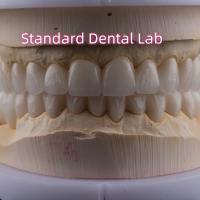 China Dental Lab Full Arch Zirconia Porcelain Crowns PFZ Crown ISO FDA CE for sale