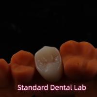 China High Esthetic BruxZir Full Contour Zirconia Crowns PFZ Bridge for sale