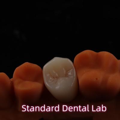 China High Esthetic BruxZir Full Contour Zirconia Crowns PFZ Bridge for sale