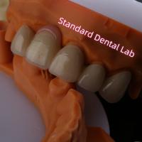 China Highly Biocompatible PFZ Porcelain Layered Zirconia With Pink Gum for sale
