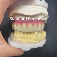 China Malo Bridge Hybrid Zirconia All On Four / Six Zirconia Implant Bridge TItanium Bar for sale