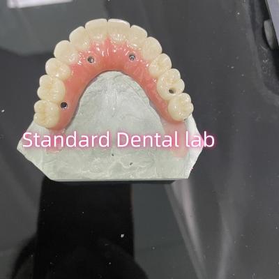 China All On Four Six Ivoclar Zirconia Implant Bridge TItanium Bar With Pink Gum Porcelain for sale