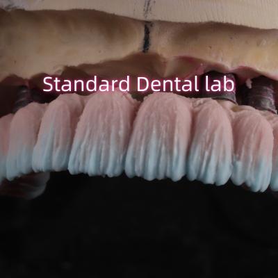 China Zirconia Implant Bridge Screw Retained With Pink Gum Porcelain for sale