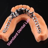 China Laser Printing Cobalt Chrome Metal Framework Partial Denture Ni Be Free for sale