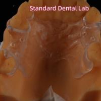 China Removable Clear Acrylic Partial Denture Clasps Retentive Natural Looking for sale