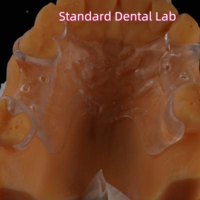 China Removable Clear Acrylic Partial Denture Clasps Retentive Natural Looking for sale