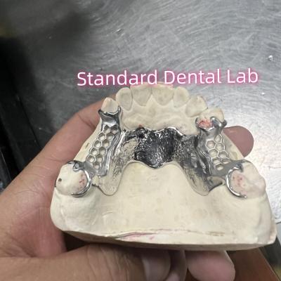 China Cobalt Chrome Cast Frame Partial Denture Vitallium 2000 for sale