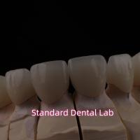 China PFZ Dental Layered Ceramic Zirconia Bridge With Incisal Translucent for sale