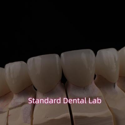 China PFZ Dental Layered Ceramic Zirconia Bridge With Incisal Translucent for sale