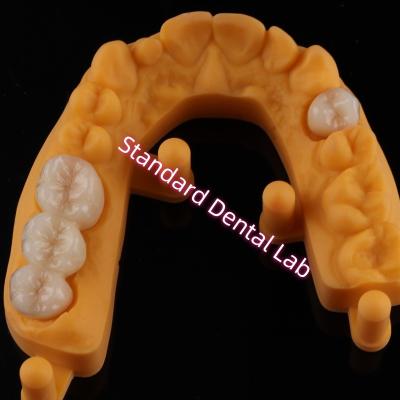 China Crown All Porcelain Ceramic Zirconia Ivoclar Esthetic Teeth OEM for sale