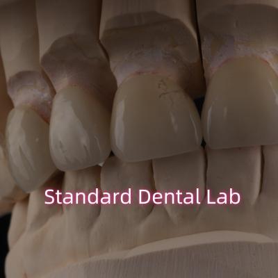 China Professional Dental Lab Zirconia Crown For Fixed Restoration for sale