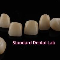 China Dental Strong Layered Zirconia Crowns Full Upper Arch Restoration for sale