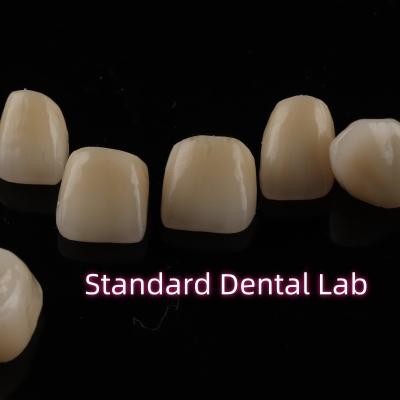 China Dental Strong Layered Zirconia Crowns Full Upper Arch Restoration for sale