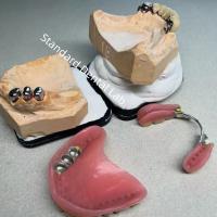 China High Esthetics CAD CAM Tooth Partial Denture Attachment Replacement Standard Dental Lab for sale