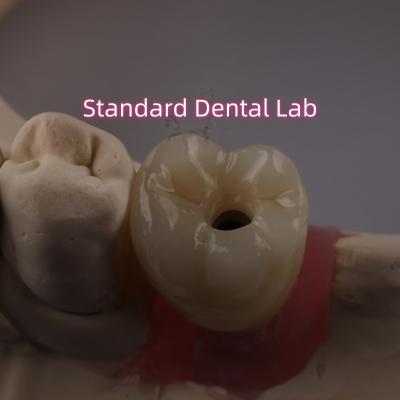 China Screw Retained Dental Implant Crown PFZ Porcelain Layered Zirconia for sale
