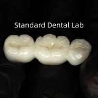 China Full Contour High Translucency Solid Zirconia for sale