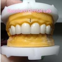 China Ivoclar Zirconia Crown Veneers High Translucency Esthetic for sale
