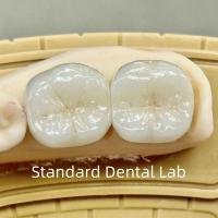 China Dental Lab Crowns Translucent Full Contour Zirconia With Superior Strength for sale