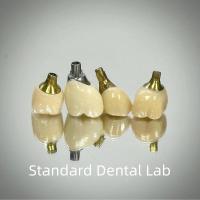 China Professional Zirconia Screw Retained Implant Crown Titanium CAD CAM for sale