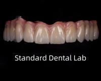 China Titanium Full Zirconia Bridge Dental Translucency On Implant Bar for sale