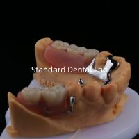 China Alloy Metal Partial Denture Framework 3 Shape Exocad Laser Printing Lower Cast Partial Finish for sale